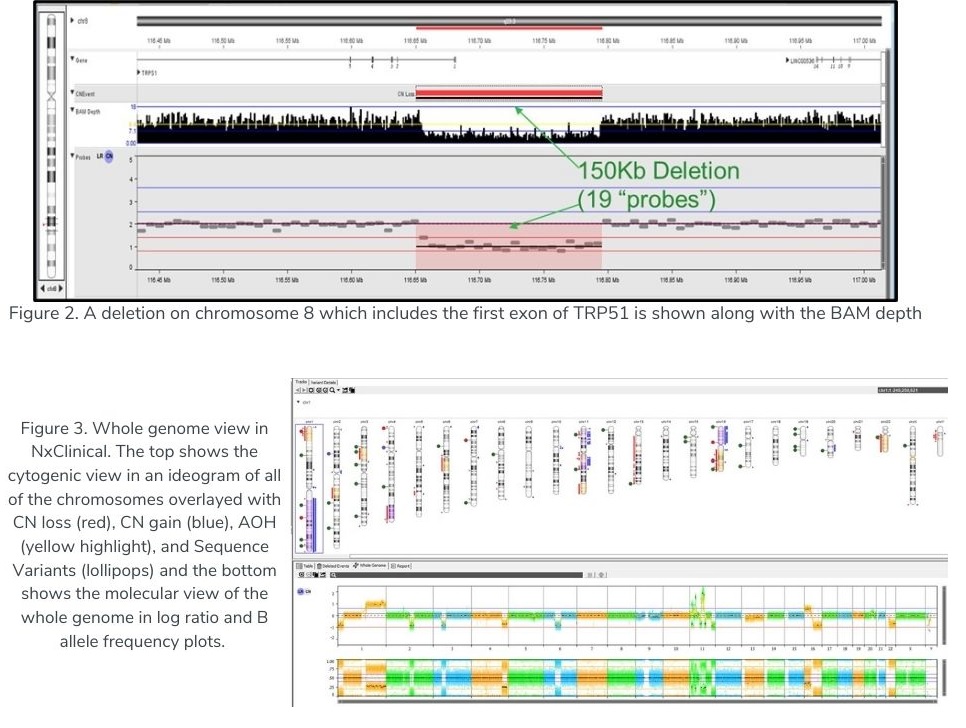 Copy Number Variation (CNV) Analysis: A Guide for Clinical Researchers